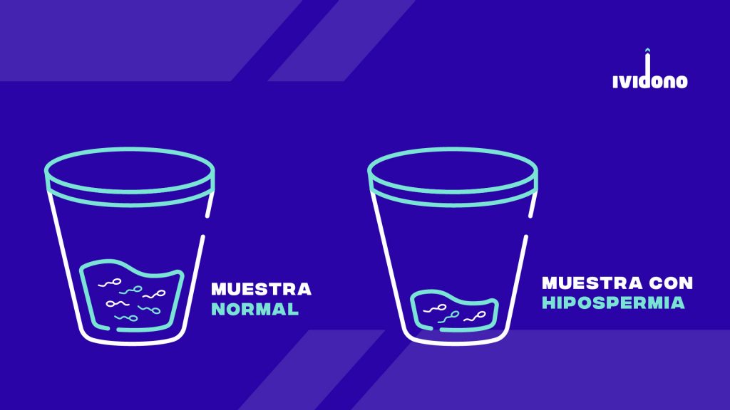 ¿Qué es la hipospermia?